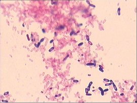 魏氏梭菌病_360百科