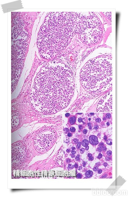精细胞图册_360百科