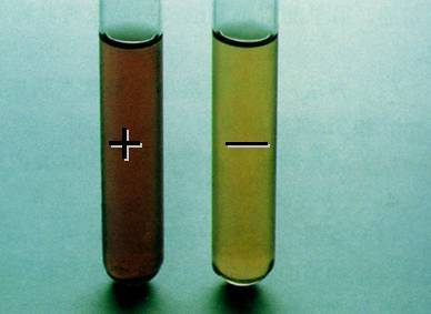 VP试验（医学微生物学 名词）_技点百科